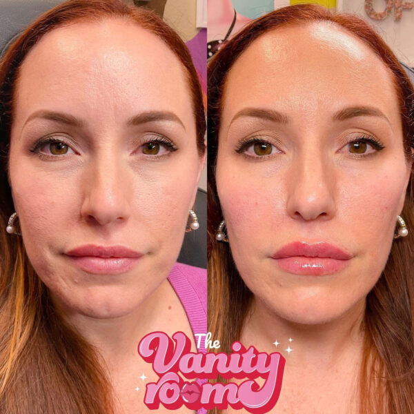 The Vanity Room Med Spa in Orlando, FL